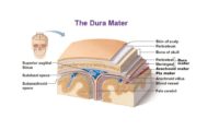 Dura Mater, Pia Mater, Why does it Matter? - Dr. Kevin Gyurina